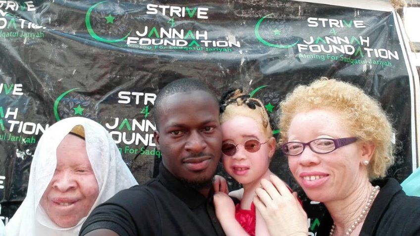 Albinism Umbrella - a Charities crowdfunding project in Biggleswade by ...