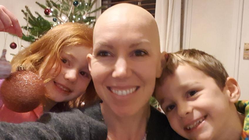 'The Lady with no Hair' - a Charities crowdfunding project in Chesham ...